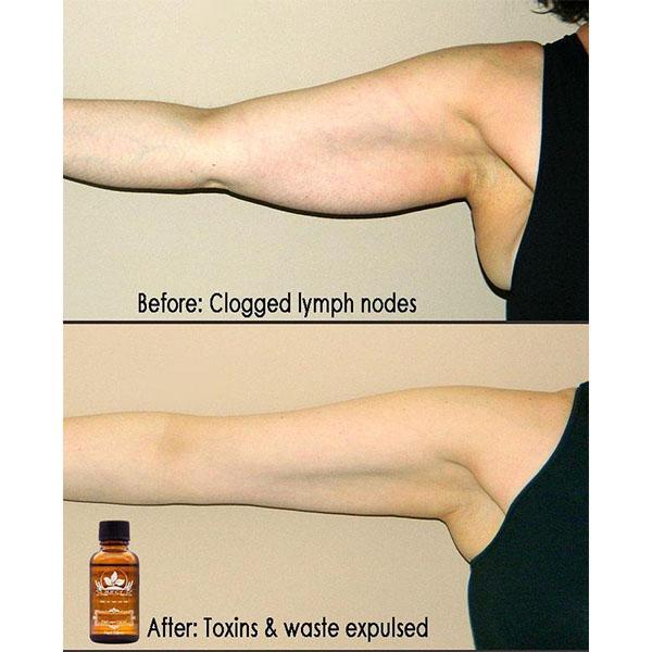 Lymphatic Drainage Ginger Oil Massage Oil – golly.co.nz